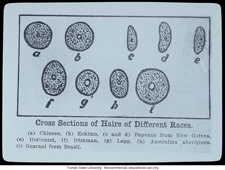"Cross sections of hairs of different races" :: CSHL DNA Learning Center